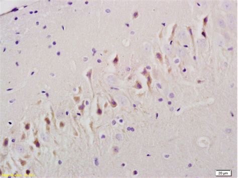 Tgf Beta Receptor 1 Polyclonal Antibody Bs 0638r