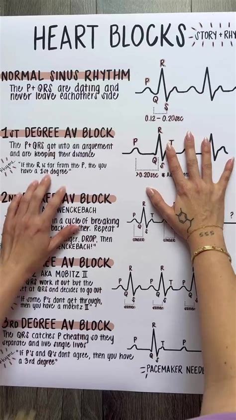 Heart Blocks In Love Story 😍 Ctto Nars Sharke Nars Sharke · Original Audio