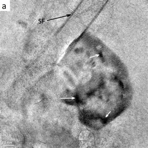Tem Micrograph Of Trapped Dislocations In A Nano Grain A