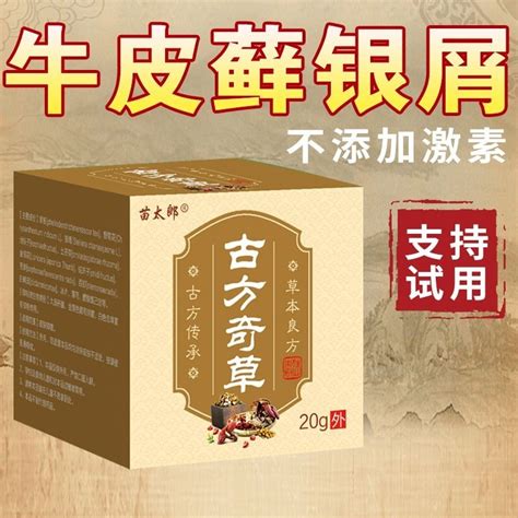 Psoriasis Psoriasis Itchy Skin Eczema Tinea Capitis Tinea Manuum And Pedis Anti Itch Skin