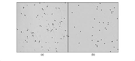 A Image Of Real Human Semen Sample B Image Of Simulated Semen