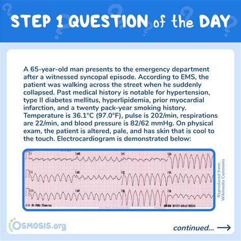 Usmle® Step 1 Question Of The Day Syncopal Episode Osmosis Blog