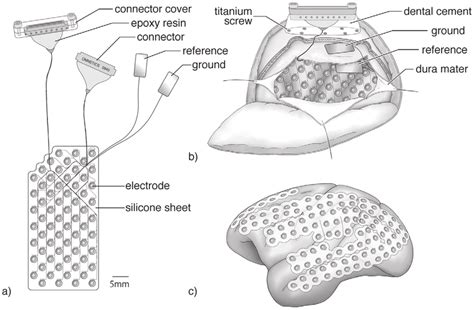 ECoG Array Implantation And Cortical Coverage A Sixty Four Channel