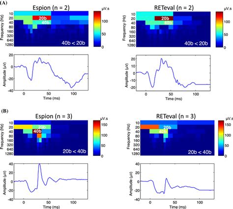 Scalograms With Accompanying Erg Waveforms Of The Discrete Wavelet