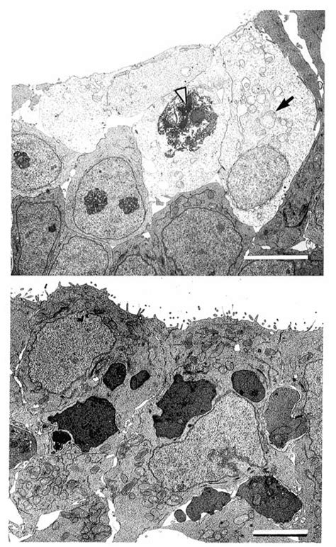 Electron Micrograph Embryonic Disk Blastocyst Treated Sow Day Ii