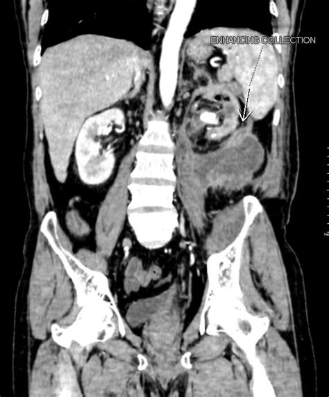 M D C T Scan Urography X Ray House