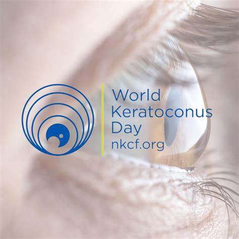 National Keratoconus Foundation On Linkedin Keratoconus Nkcf Kc