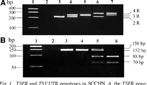Figure 1 From Thymidylate Synthase 5′ And 3′ Untranslated Region Polymorphisms Associated With
