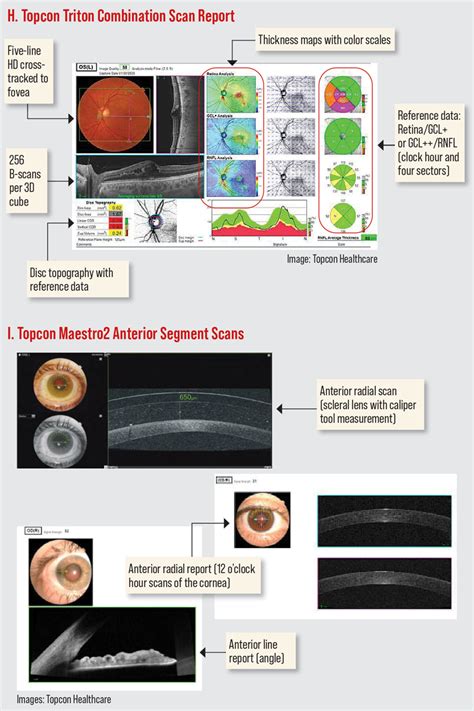 Oct Whats Under The Hood