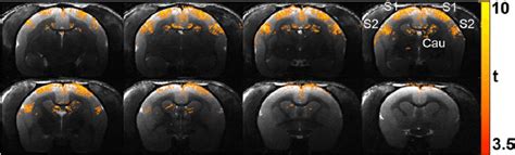 Functional Mri Bold Activation Maps Obtained With High Spatial