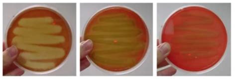 Micro Lab Unit 2 Streptococcus And Enterococcus Differentiation
