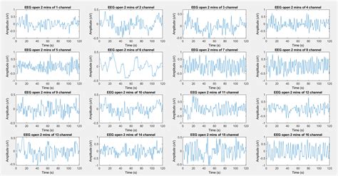Noise High Impedance Electrode Cap With Cyton Daisy — Openbci Forum