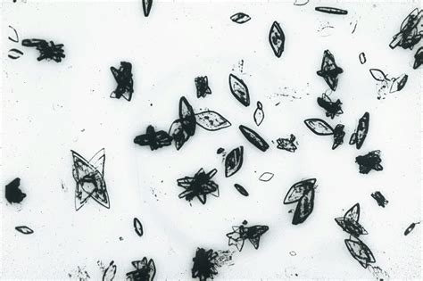 Types Of Crystals In Urine