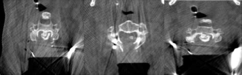 Surgical Neurology International