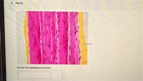 Solved Identify The Highlighted Structures Identify The