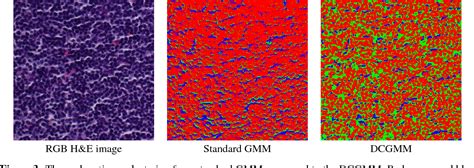 Figure 3 From Histopathology Stain Color Normalization Using Deep Generative Models Semantic