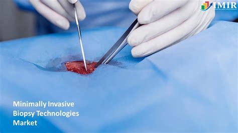Minimally Invasive Biopsy Technologies Market Share Trends And