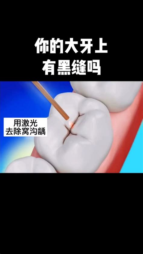牙齿上的黑线 表面 第2页 大山谷图库
