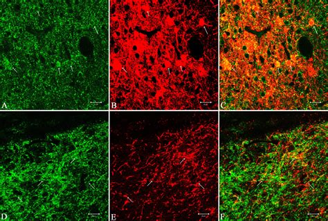 Cart Containing Neurons In The Nucleus Accumbens Project To The Ventral Pallidum In The Rat And