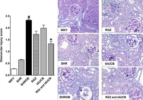Glomerular Injury Glomerular Injury Was Determined In Wistar Kyoto