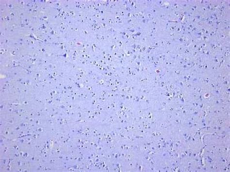 Novus Biologicals Brain Frontal Lobe Tissue Slides Parkinsons Paraffin 5 Slides Buy Online