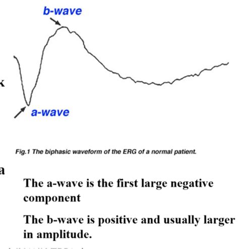 Visual Electrophysiology Part 1 Vsp Flashcards Quizlet