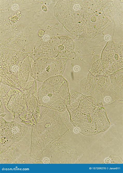 Renal Epithelial Cells Urine Stock Images Download 12 Royalty Free Photos