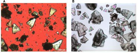 Crystallization In Lactose Refining—a Review Wong 2014 Journal Of Food Science Wiley