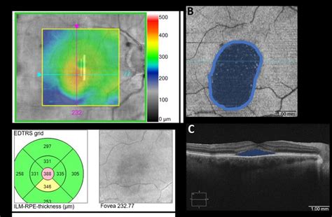 Visualization Of Methods In Optical Coherence Tomography OCT And Download Scientific Diagram