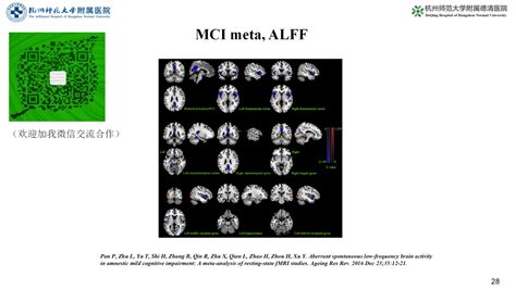 【学术报告整理】功能磁共振对异常脑活动精准定位并引导精准定位tms治疗 脑医汇