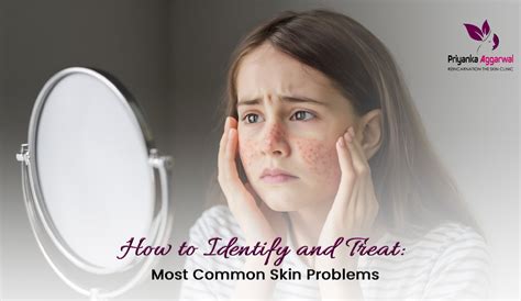How To Identify Common Skin Problems Dr Priyanka Aggarwal