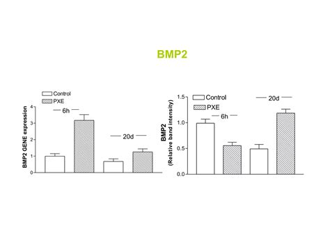 The Role Of Fibroblast In Ectopic Calcification Ppt