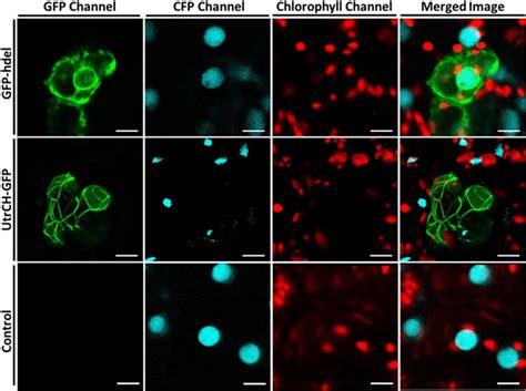 Subcellular Localization Of Endoplasmic Reticulum Targeted Gfp