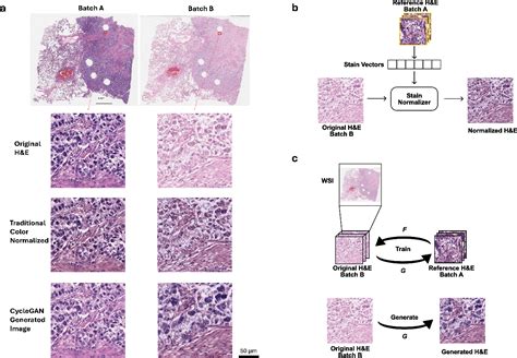 Impact Of Stain Variation And Color Normalization For Prognostic Predictions In Pathology