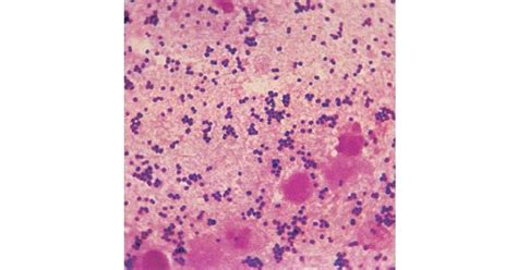 Staphylococcus Aureus Morphology Culture And Biochemical Reaction