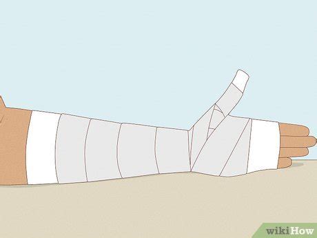 How To Apply Splints Makeshift And Medical Splint Tutorials