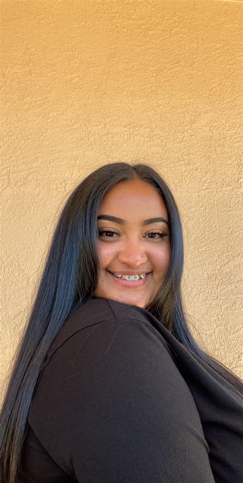 3 Years Later 🫶🏽 R Braces