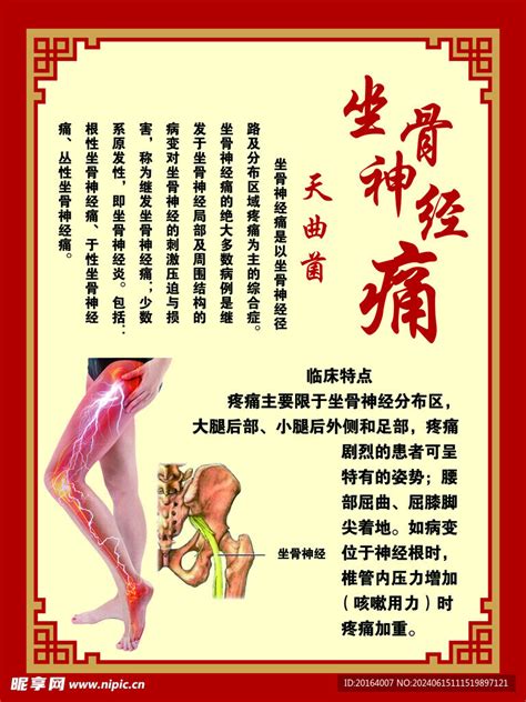 坐骨神经痛设计图 广告设计 广告设计 设计图库 昵图网