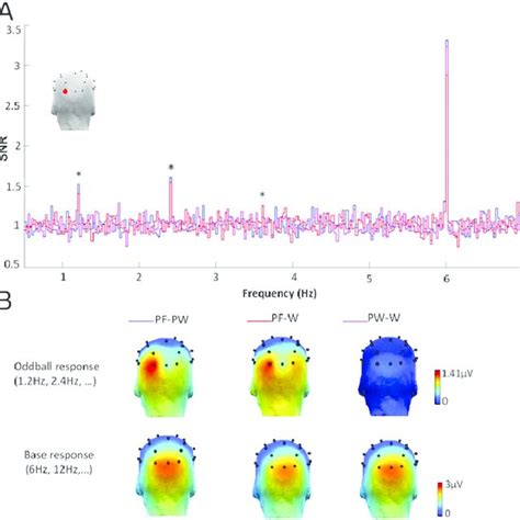 Grand Averaged N 40 Snr Eeg Spectra And Scalp Topographies Back Of Download Scientific