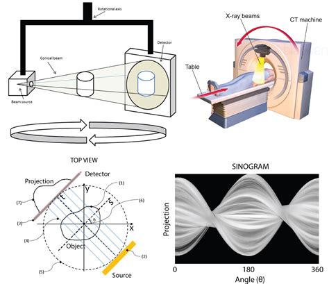 Desktop Ct And 3d Scanner With Arduino 12 Steps With Pictures