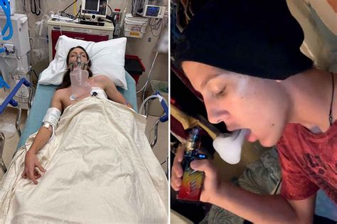 I Quit Vaping At 19 — After My Lungs Collapsed 4 Times