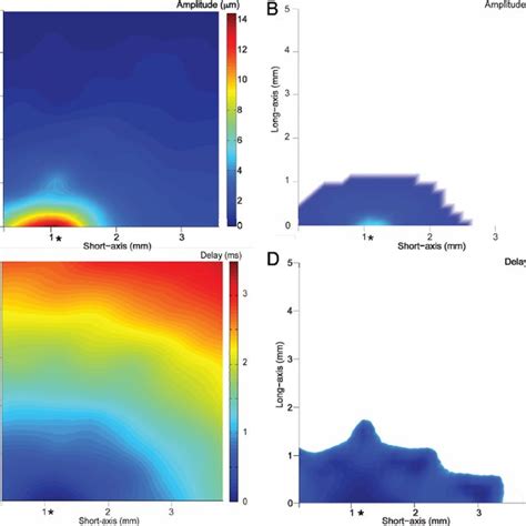 Phase Sensitive Optical Coherence Tomography Based Elastography Imaging Download Scientific
