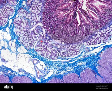 Light Microscopy Of The Inner Lining Mucosa Of The Small Bowel This