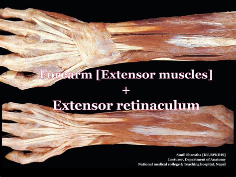 Extensor Compartment Of Forearm And Extensor Retinaculum ~ Shortcuts Of Human Anatomy