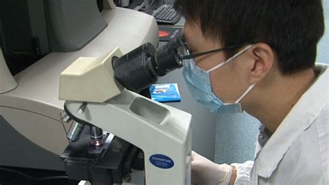 单纯性紫癜治疗方法 内科