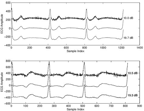 Enhanced Ecg As Compared With Its Original And Noise Contaminated One Download Scientific