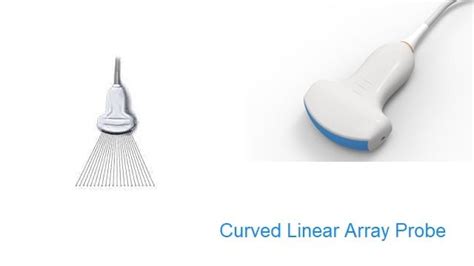 Complete Ultrasound Sonography Computer Technology