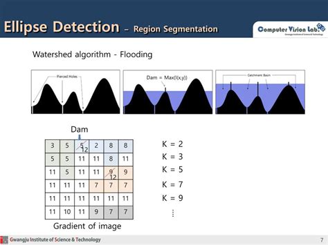 Ppt Polyp Detection In Colonoscopy Video Using Elliptical Shape Feature Powerpoint