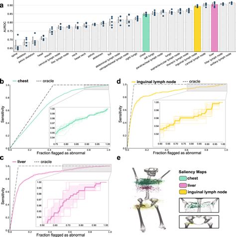 Combining Weakly Supervised Multi Task Learning With Spatial Attention