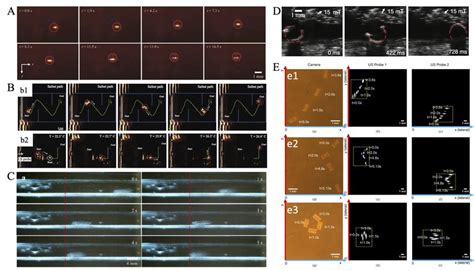 Localization Of An Individual Microrobot Under B Mode Us Imaging A Download Scientific